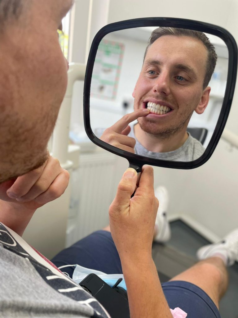 Invisalign Smile Transformation | Amazing Results | IG2